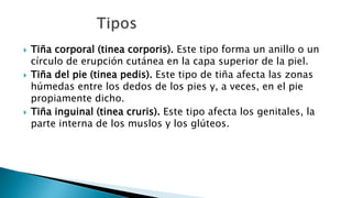 Dermatitis por hongos en la piel | PPTX