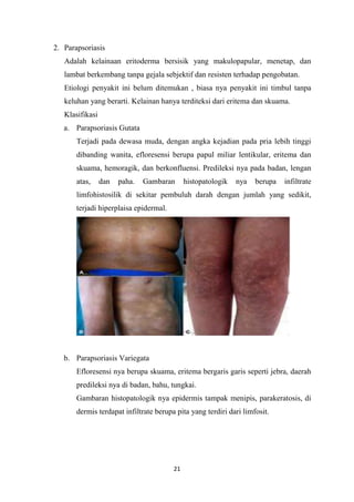 Dermatitis seboroik | DOCX