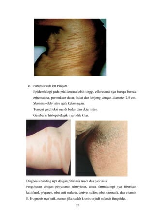 Dermatitis seboroik | DOCX