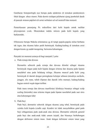 Dermatitis seboroik | DOCX