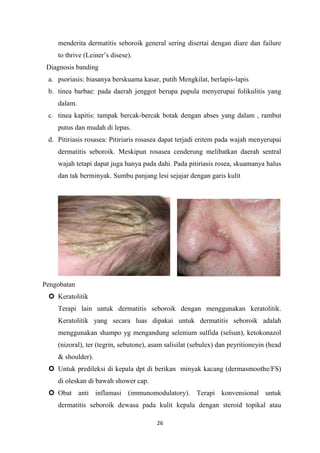 Dermatitis seboroik | DOCX