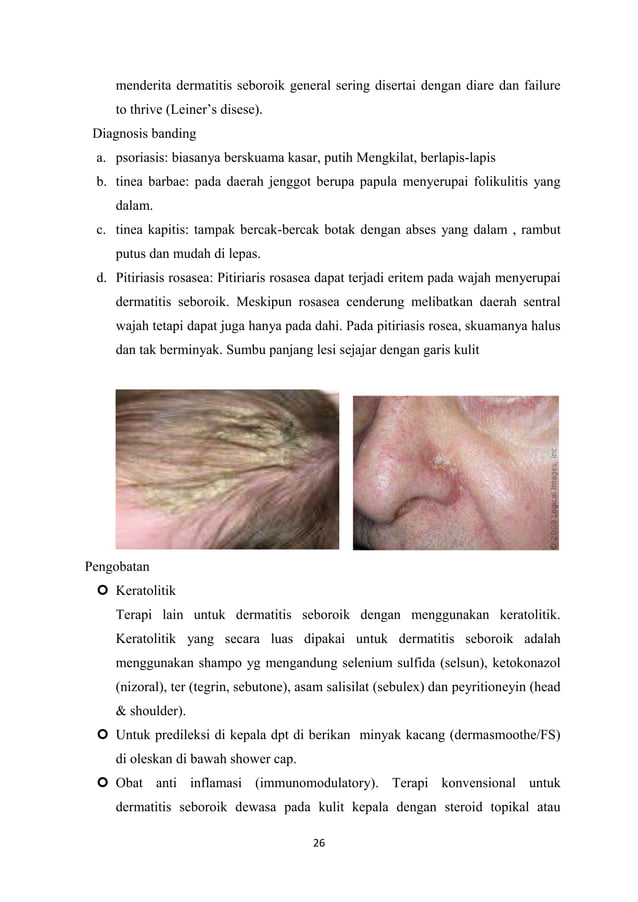 Dermatitis seboroik | DOCX