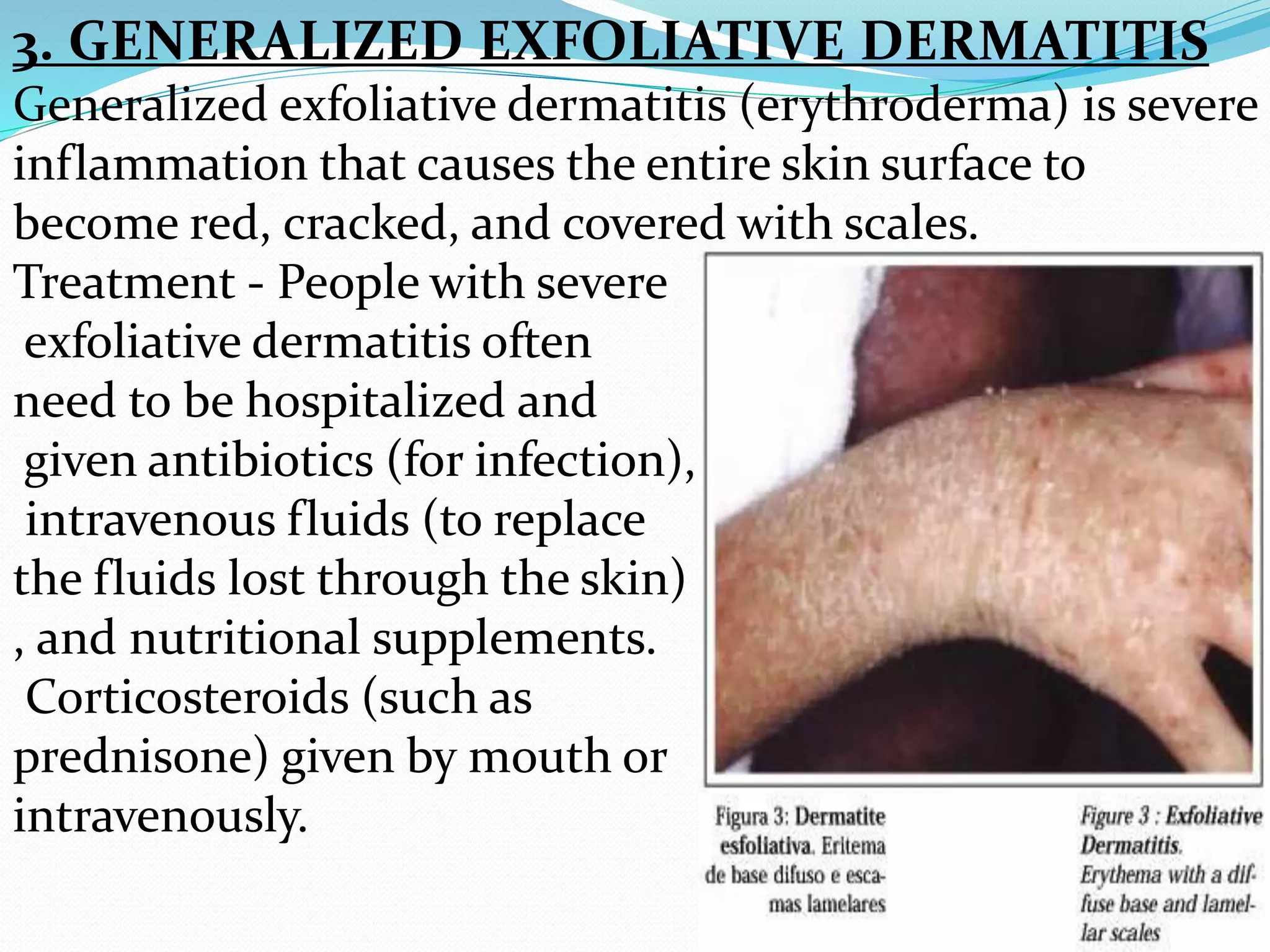 Dermatitis slide | PDF