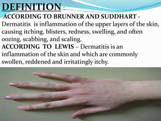 Dermatitis slide | PDF