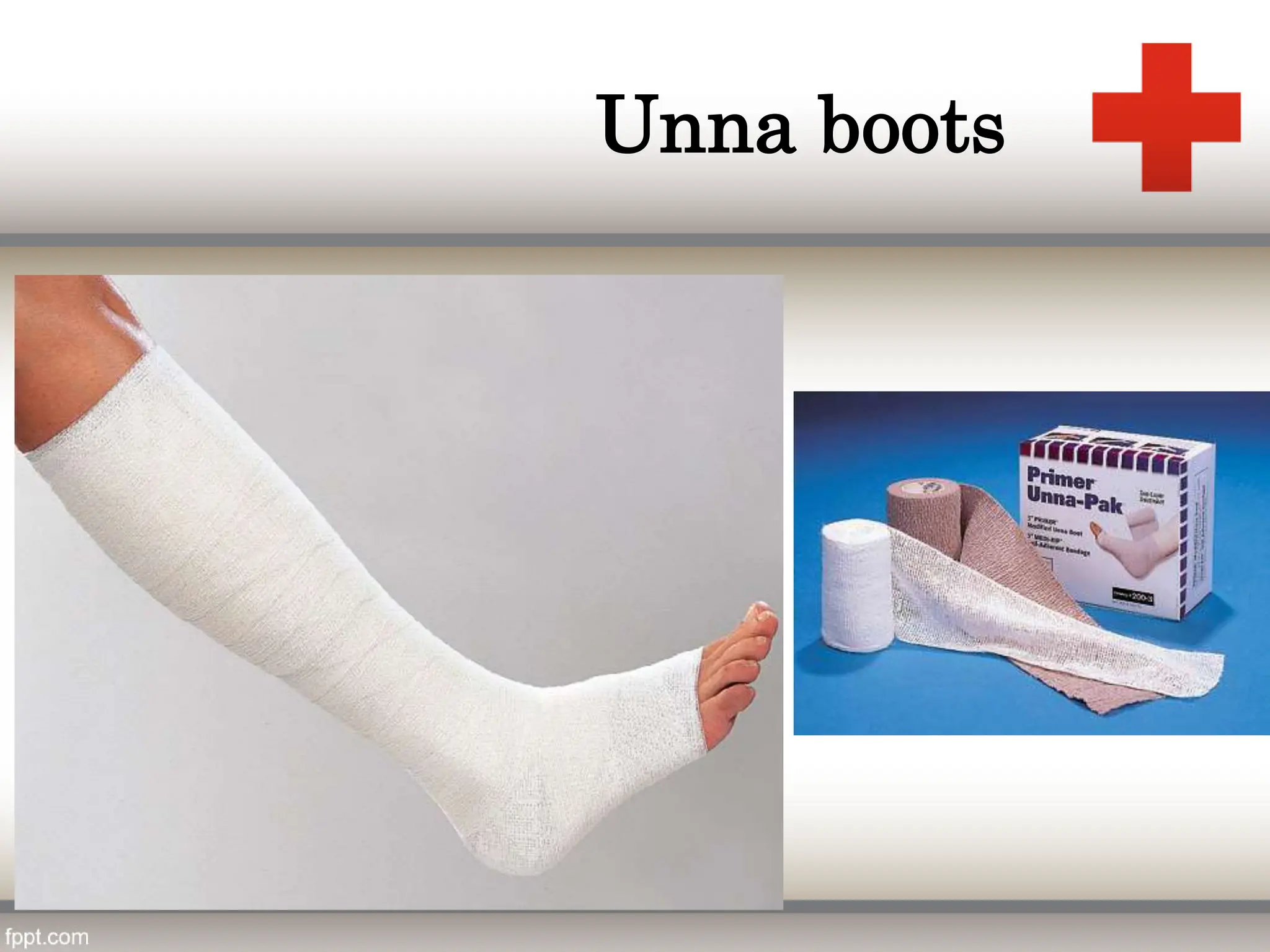 Dermatitis statis dermatitis statis dejj | PPTX