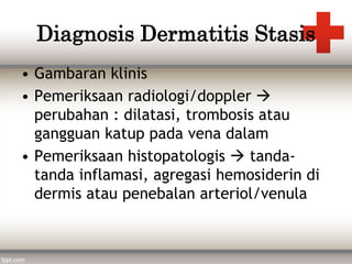 Dermatitis statis dermatitis statis dejj | PPTX