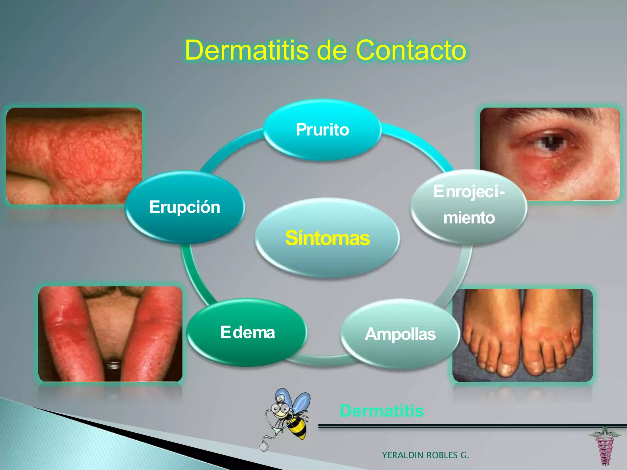 DERMATITIS, TIPOS Y TRATAMIENTOS.pptx