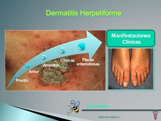 DERMATITIS, TIPOS Y TRATAMIENTOS.pptx