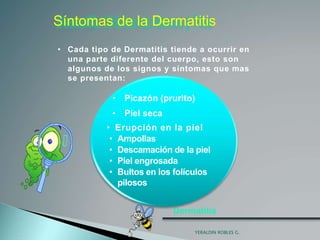 DERMATITIS, TIPOS Y TRATAMIENTOS.pptx