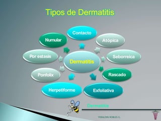 DERMATITIS, TIPOS Y TRATAMIENTOS.pptx