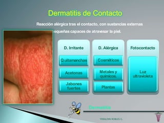 DERMATITIS, TIPOS Y TRATAMIENTOS.pptx