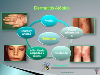 DERMATITIS, TIPOS Y TRATAMIENTOS.pptx