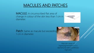 Dermatitis in animals types and lesions | PPTX