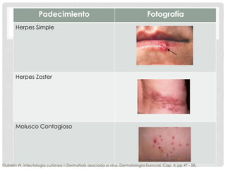 Dermatitis viral | PPTX