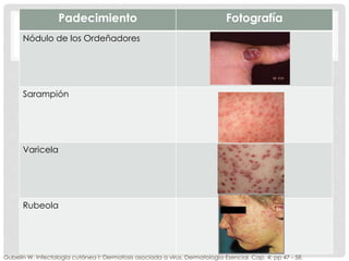 Dermatitis viral | PPTX