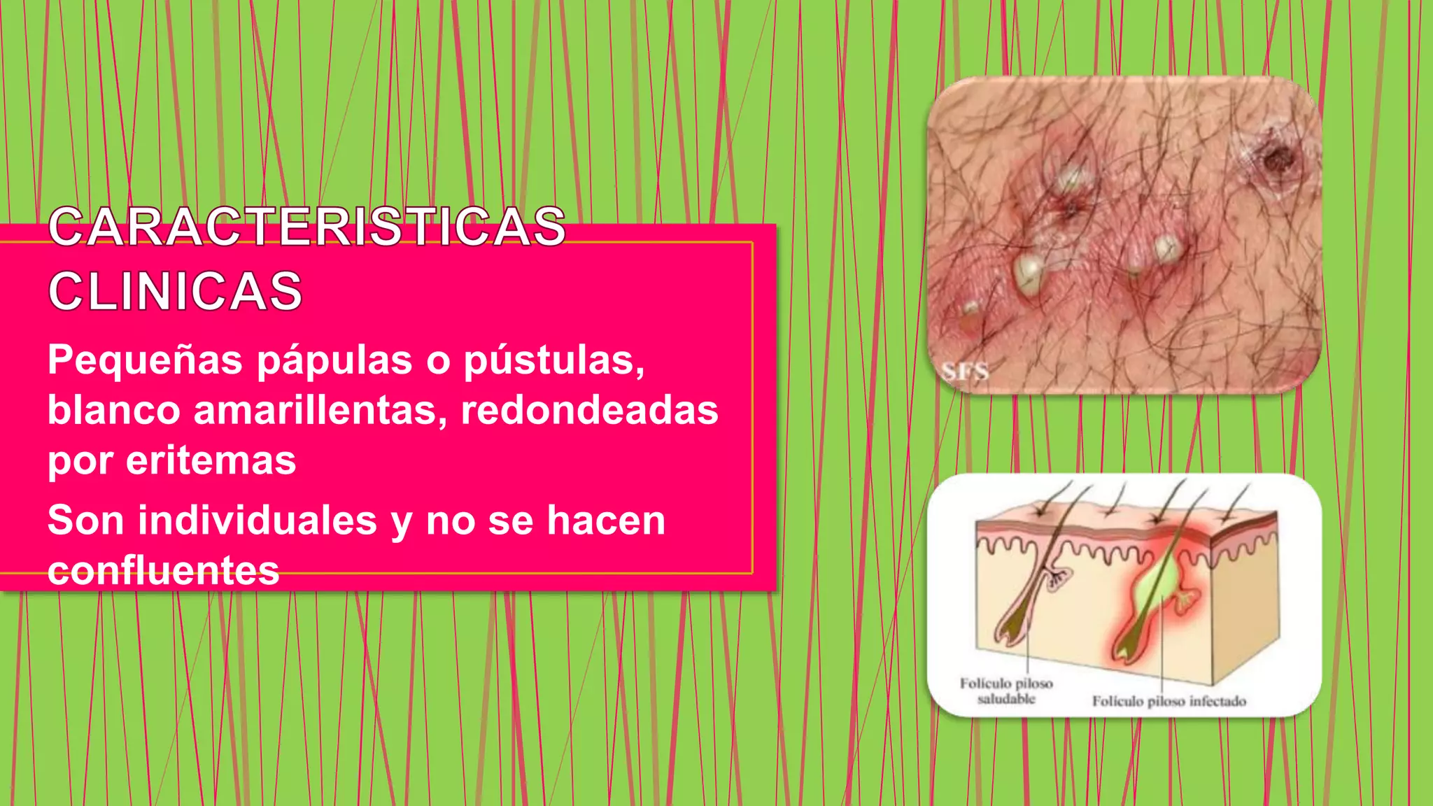 PIODERMITIS PIODERMIAS DERMATOLOGIA | PPTX