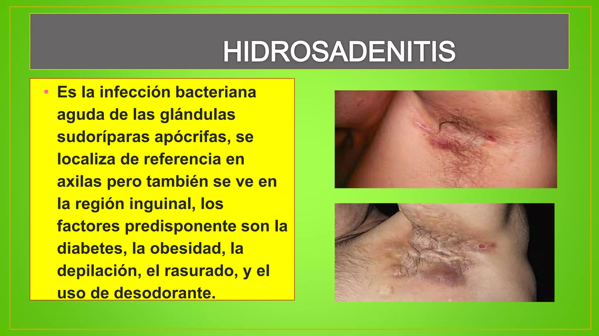 PIODERMITIS PIODERMIAS DERMATOLOGIA | PPT