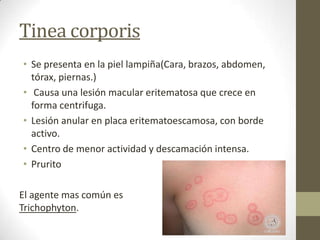 Dermatofitos | PPTX