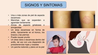 Dermatofitos | PPTX