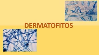 Dermatofitos | PPTX