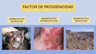 Dermatofitos | PPTX