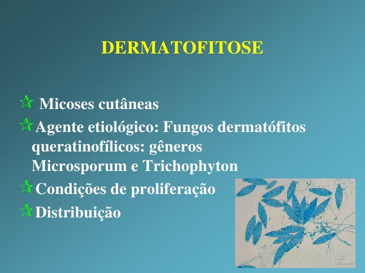 Dermatofitose x dermatofilose