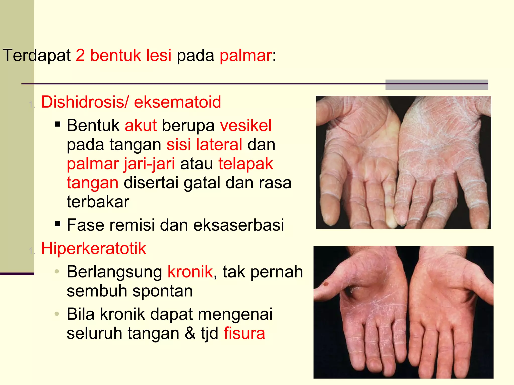 Dermatofitosis | PPT