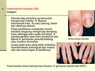 Dermatofitosis | PPT