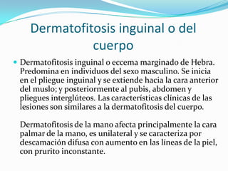 Dermatofitosis | PPTX