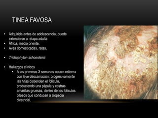 Dermatofitosis | PPT