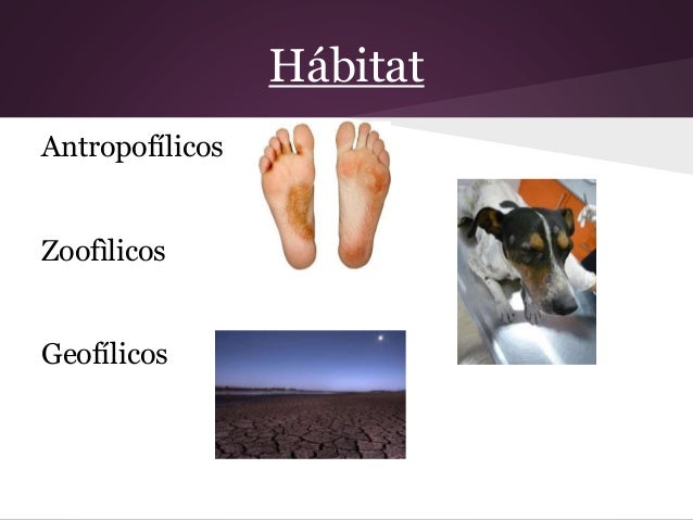 Dermatofitosis
