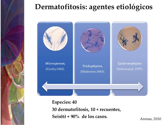 Dermatofitosis