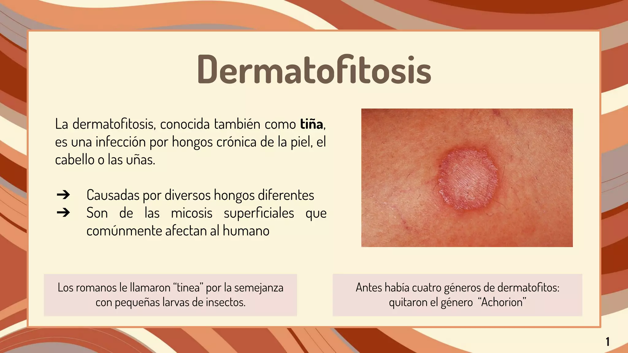 Dermatofitosis | PDF