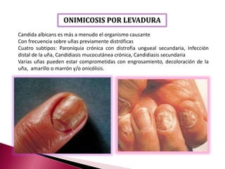 DERMATOFITOSIS -ONICOMICOSIS | PPTX