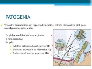 Dermatofitosis | PPTX