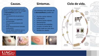 Dermatofitosis | PPTX