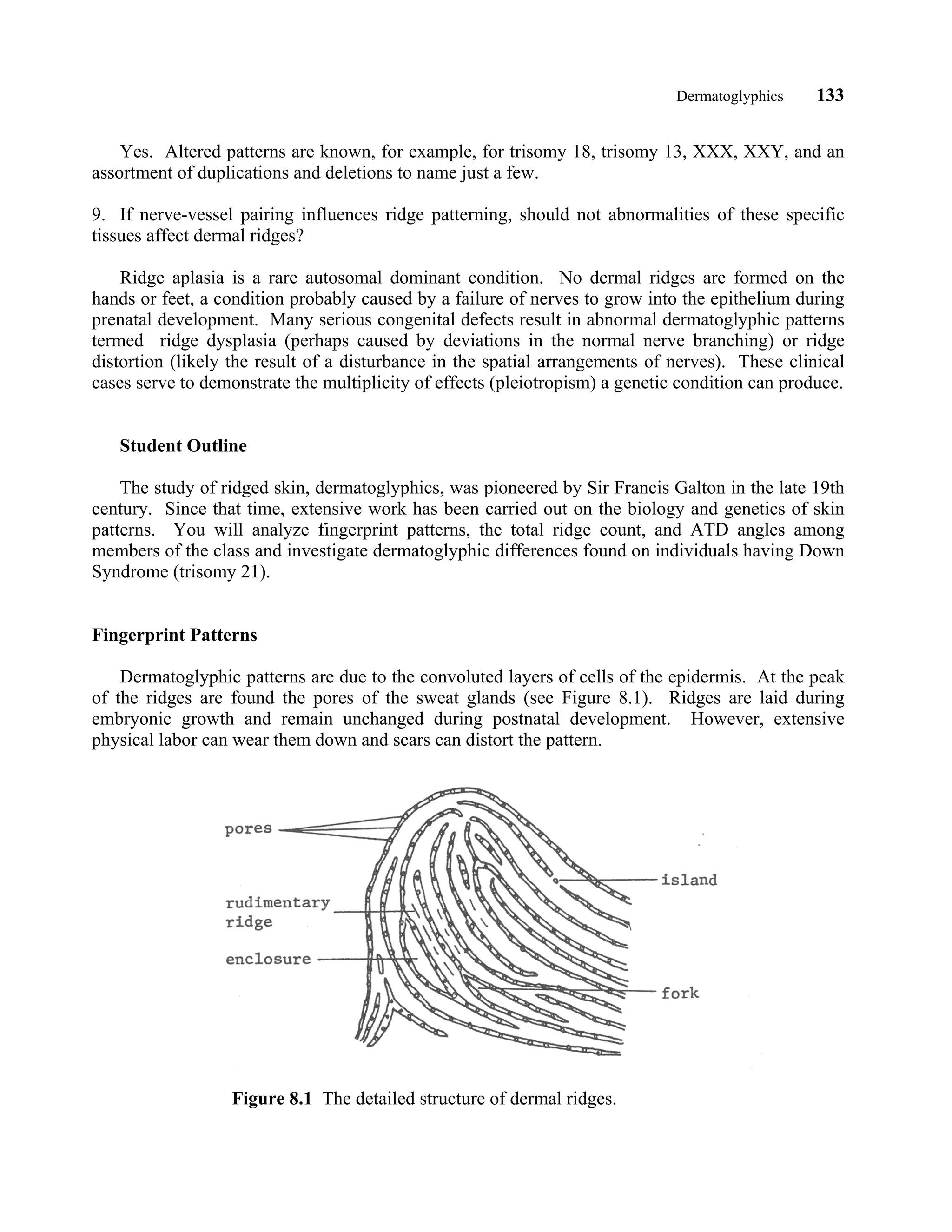 Dermatoglyphics with down | PDF