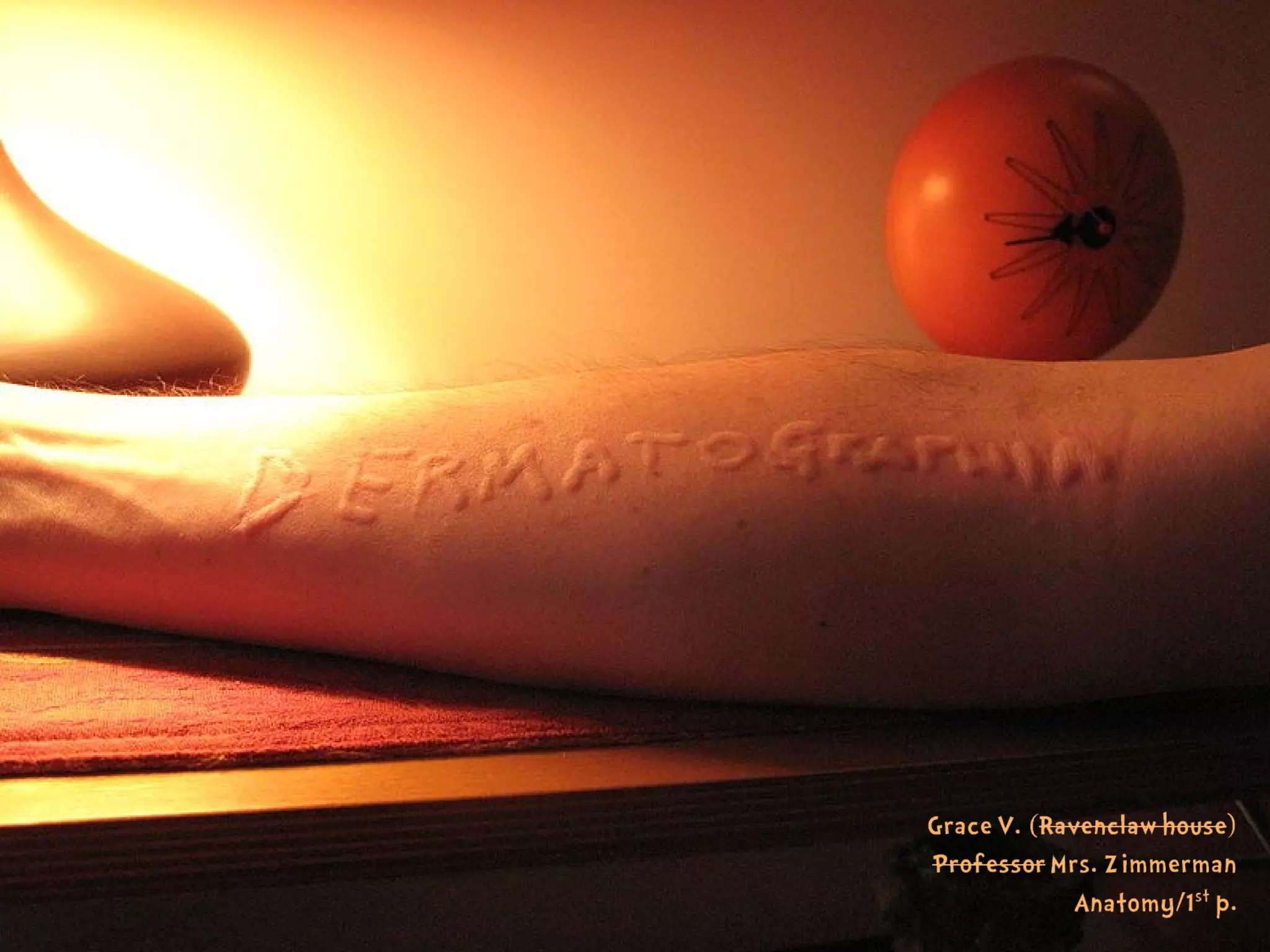 Dermatographia by Grace V. | PPT