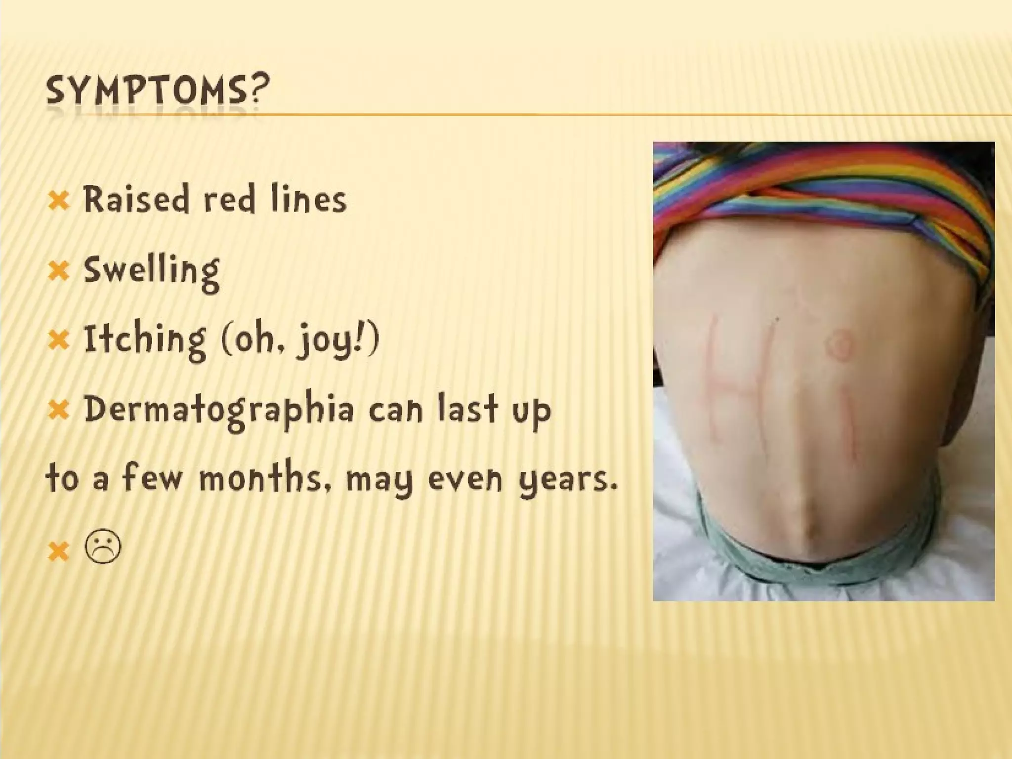Dermatographia by Grace V. | PPT