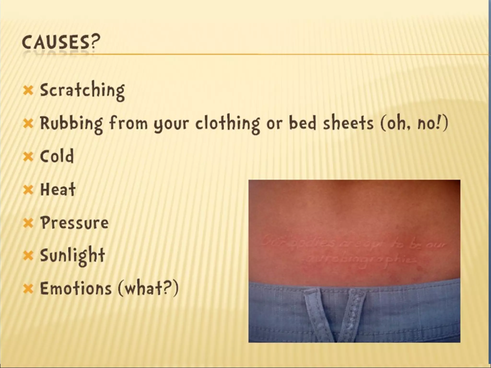 Dermatographia by Grace V. | PPT