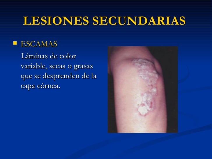 Lesiones Elementales