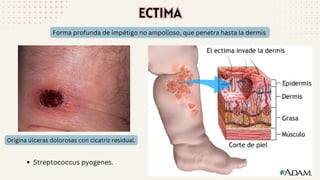 INFECCIONES BACTERIANAS DE LA PIEL DERMATOLOGIA | PDF