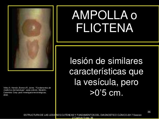 Lesiones Primarias y Secundarias de la Piel