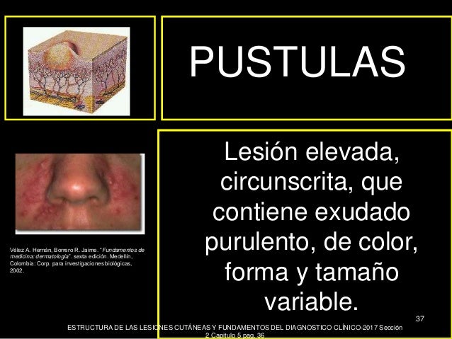Lesiones Primarias y Secundarias de la Piel