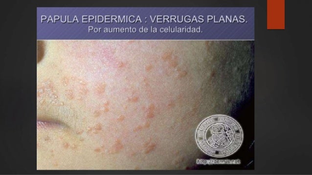 Dermatología lesiones elementales.