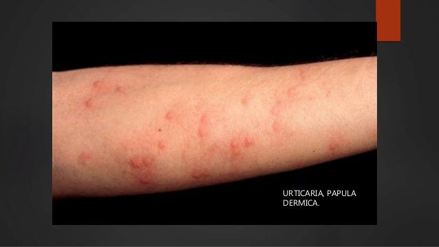 Dermatología lesiones elementales.