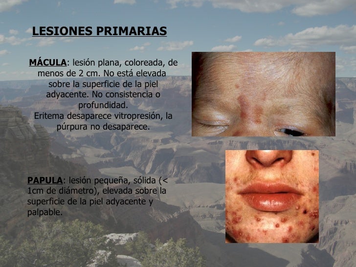 DermatologíA En Ap