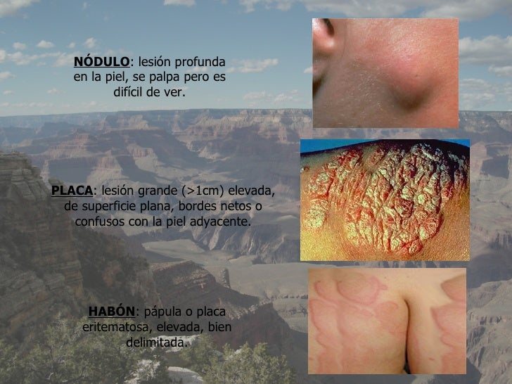 DermatologíA En Ap
