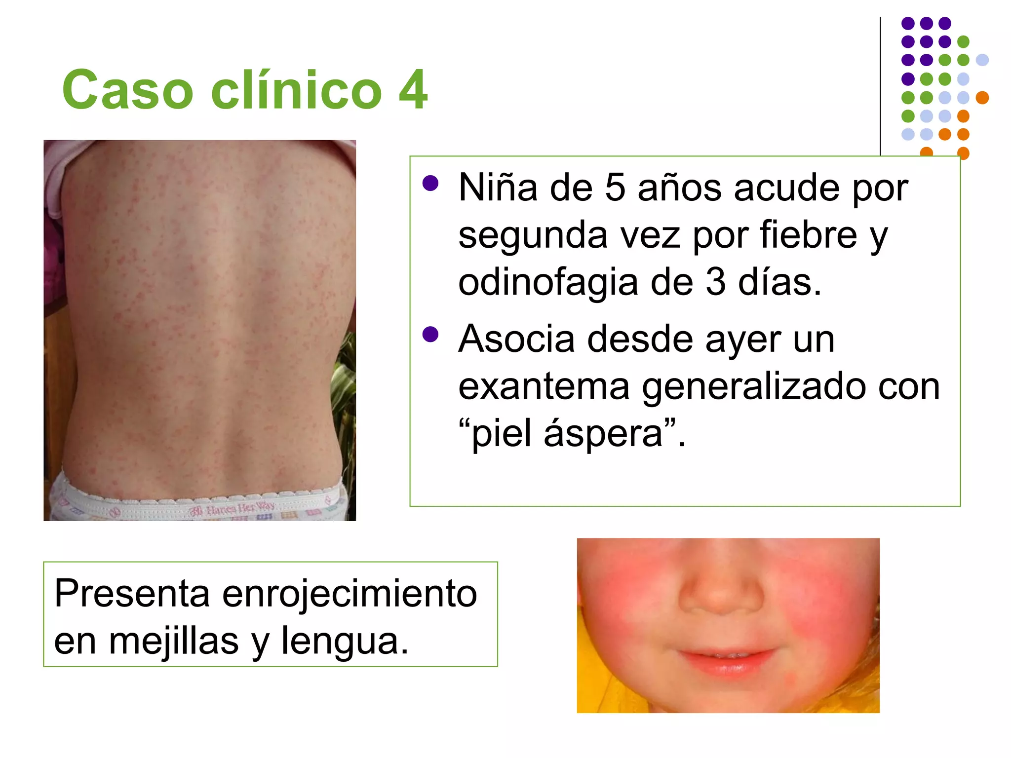 La piel de los niños (Dermatología pediátrica) | PPT