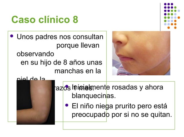 La piel de los niños (Dermatología pediátrica) | PPT